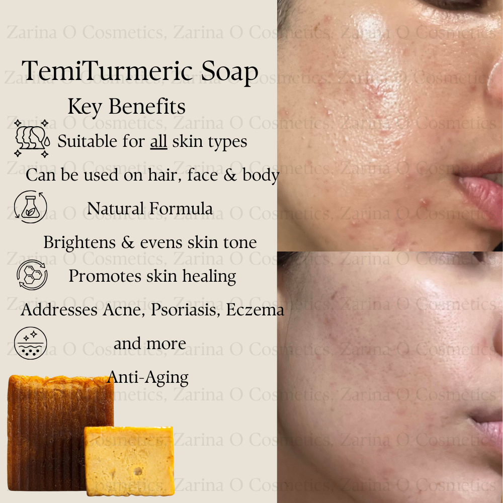 TemiTumeric Face and Body Soap | Zarina O Cosmetics